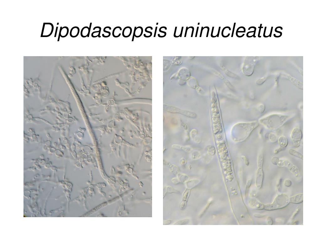 PPT - Archiascomycetes and Saccharomycetales PowerPoint Presentation ...