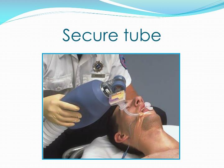 PPT - Orotracheal Intubation PowerPoint Presentation - ID:868329