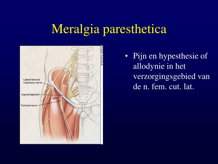 PPT - SSEP in de diagnostiek van meralgia paresthetica PowerPoint ...