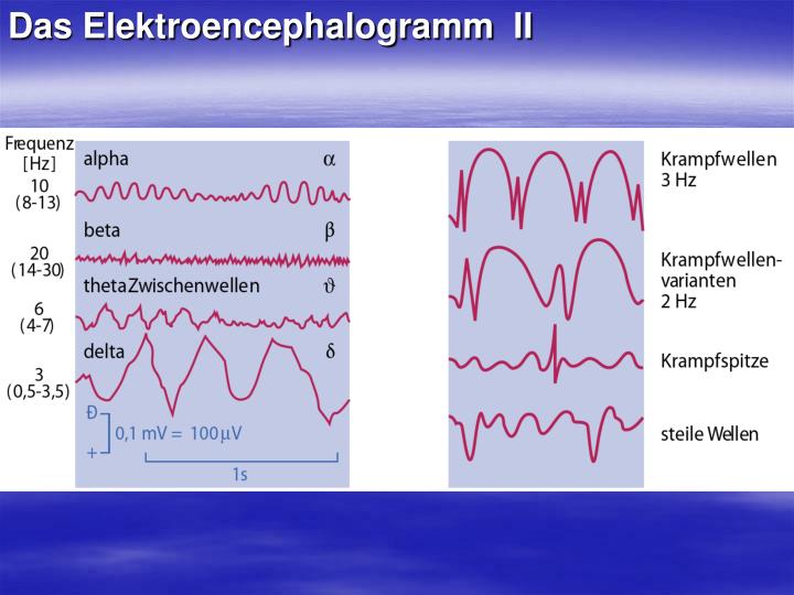 PPT - Physiologie 1-3 EEG - EKP PowerPoint Presentation - ID:870208