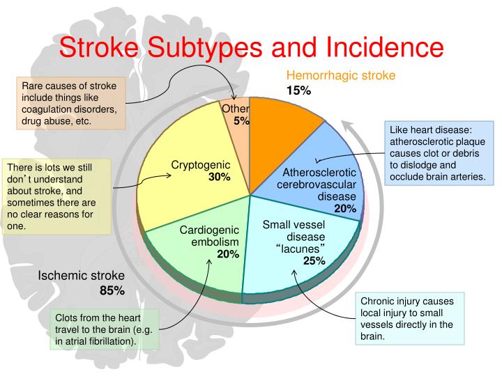 PPT - Care of the Stroke Patient Improving Patient Outcomes PowerPoint ...