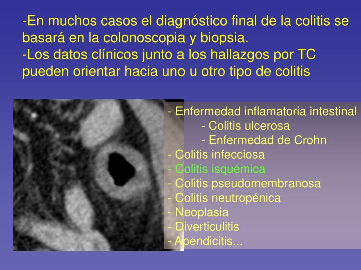 PPT - Colitis isquémica: Hallazgos TC Una frecuente causa insospechada ...