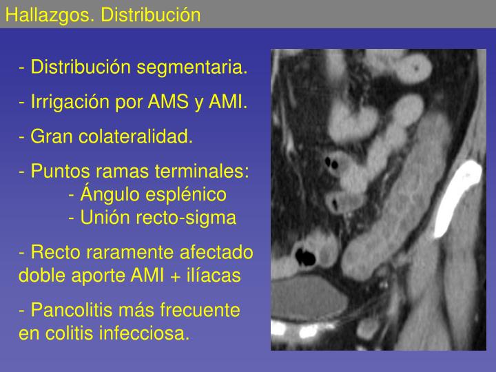 PPT - Colitis isquémica: Hallazgos TC Una frecuente causa insospechada ...