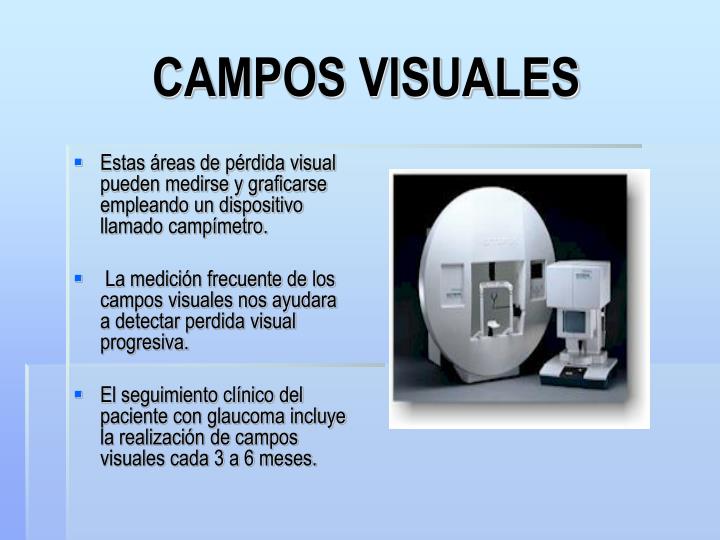 PPT - GLAUCOMA PowerPoint Presentation - ID:875033