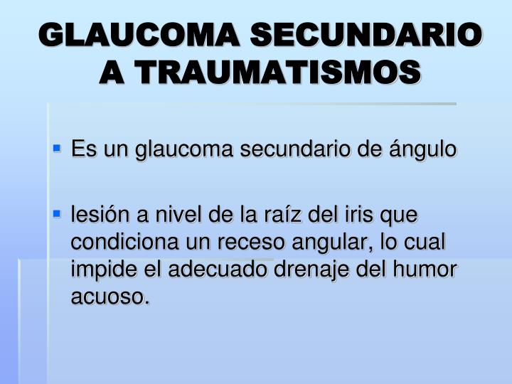 PPT - GLAUCOMA PowerPoint Presentation - ID:875033