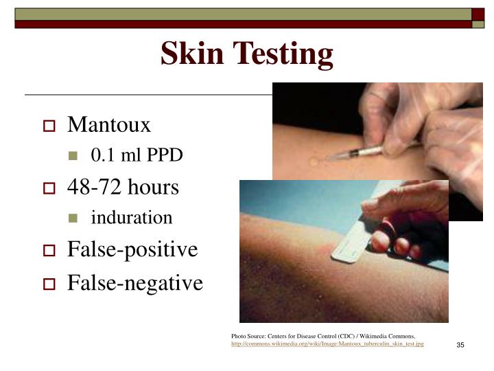 PPT - NCLEX RN Preparation Program PowerPoint Presentation - ID:875126