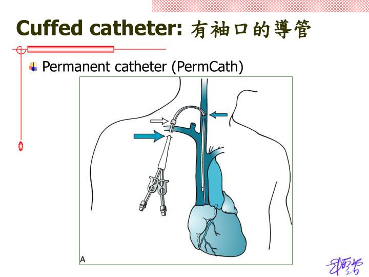 PPT - 血管通路的建立與維護 The creation and maintenance of hemodialysis vascular ...