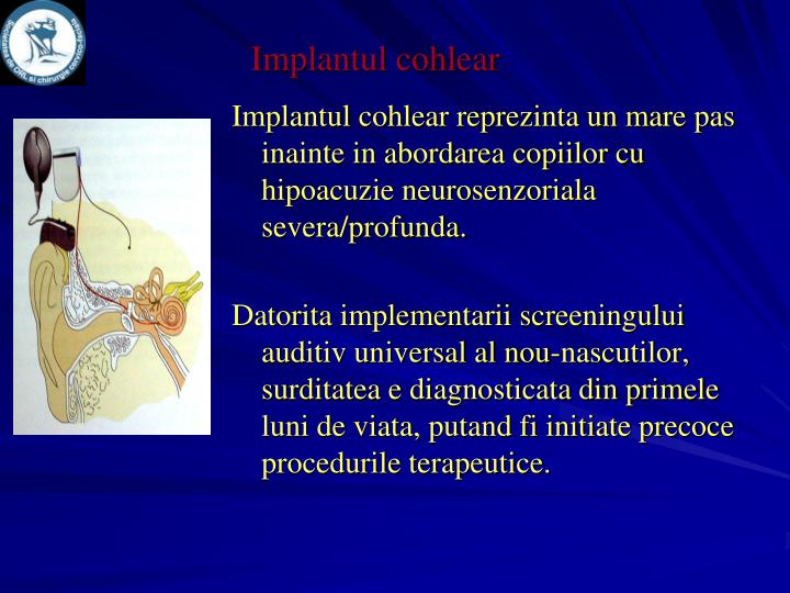 PPT - IMPLANTUL COHLEAR PowerPoint Presentation - ID:877476