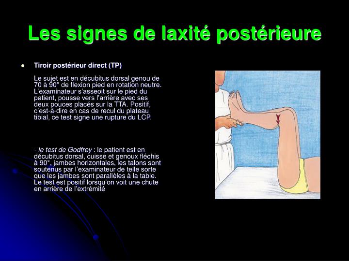 PPT - Examen du genou PowerPoint Presentation - ID:878689