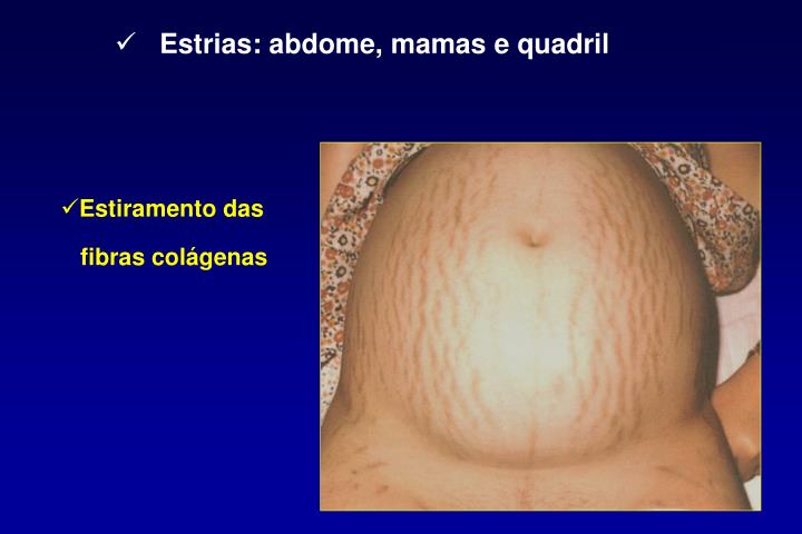 PPT - Modificações gerais do organismo materno decorrentes da gravidez ...