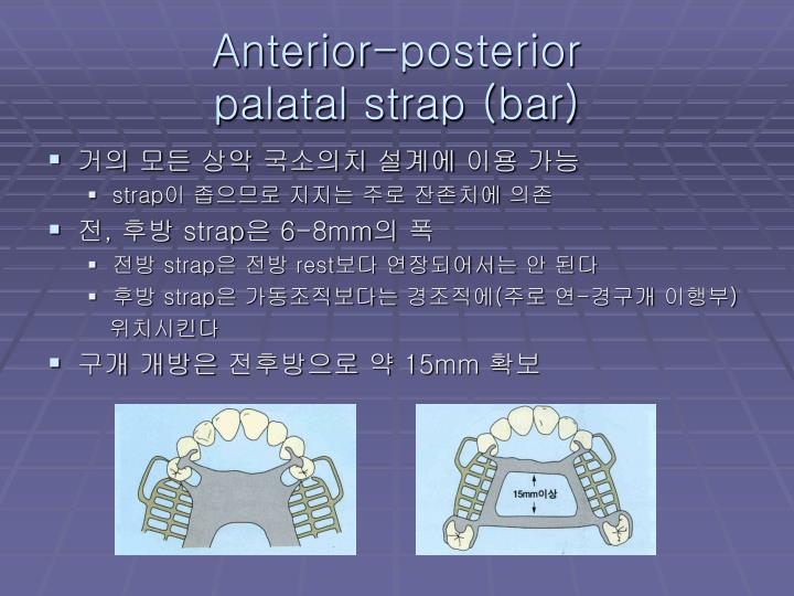 PPT - 상악 RPD 설계 PowerPoint Presentation - ID:882425