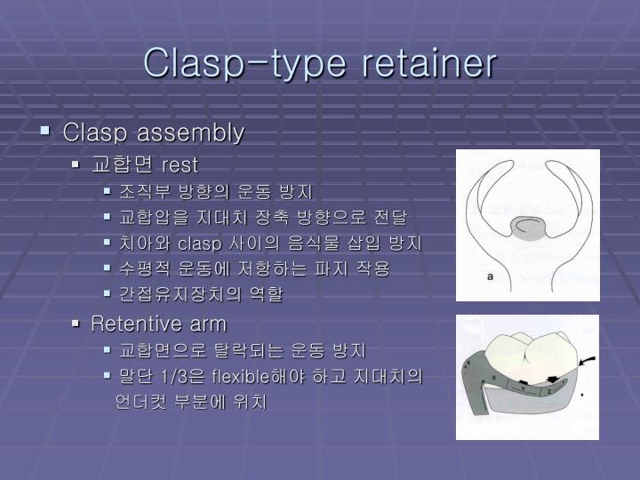 PPT - 상악 RPD 설계 PowerPoint Presentation - ID:882425