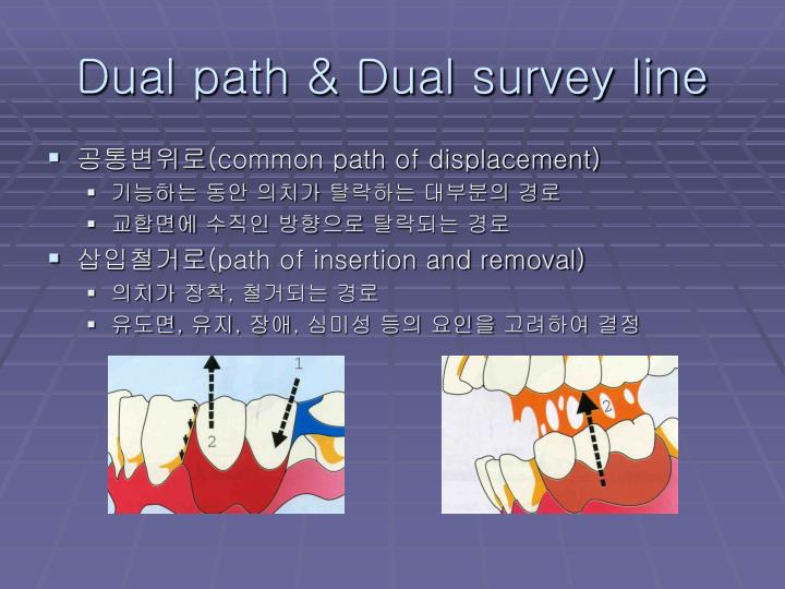 PPT - 상악 RPD 설계 PowerPoint Presentation - ID:882425