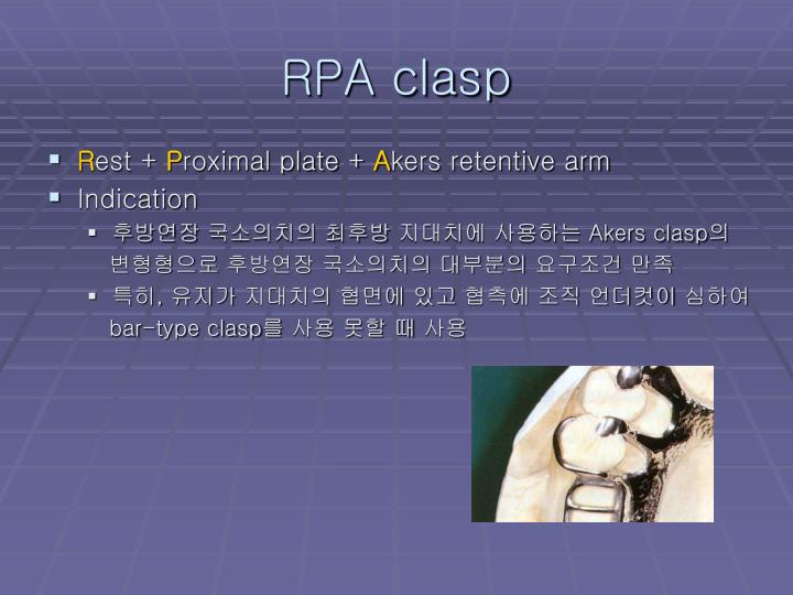 PPT - 상악 RPD 설계 PowerPoint Presentation - ID:882425