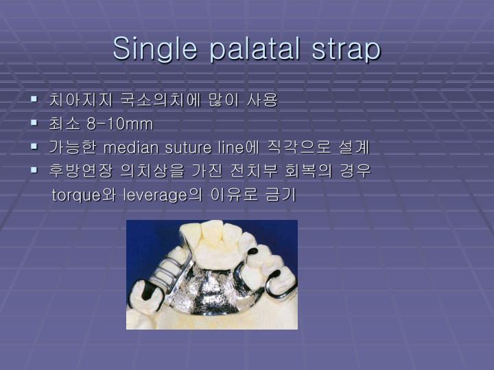 PPT - 상악 RPD 설계 PowerPoint Presentation - ID:882425