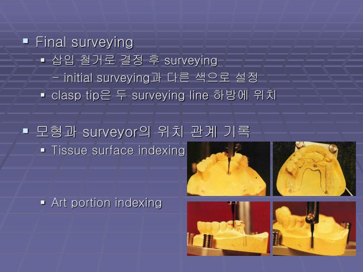 PPT - 상악 RPD 설계 PowerPoint Presentation - ID:882425