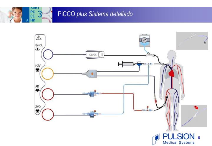 PPT - PiCCO-Technology PowerPoint Presentation - ID:883189