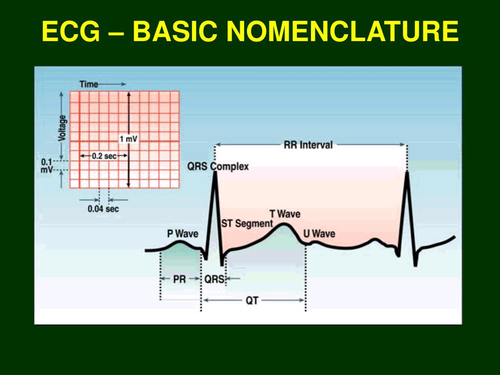 Ppt The Basics Of Ecg Interpretation Powerpoint Presentation Free ... Ppt The Basics Of Ecg Interpretation Powerpoint Presentation Free ...