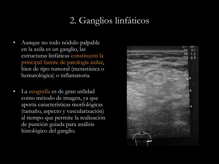 PPT - Estudio de la axila en una sección de mama PowerPoint ...