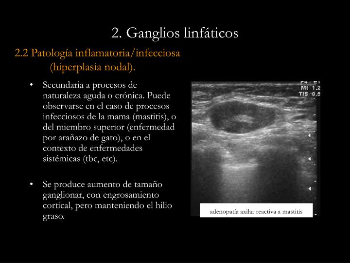 PPT - Estudio de la axila en una sección de mama PowerPoint ...