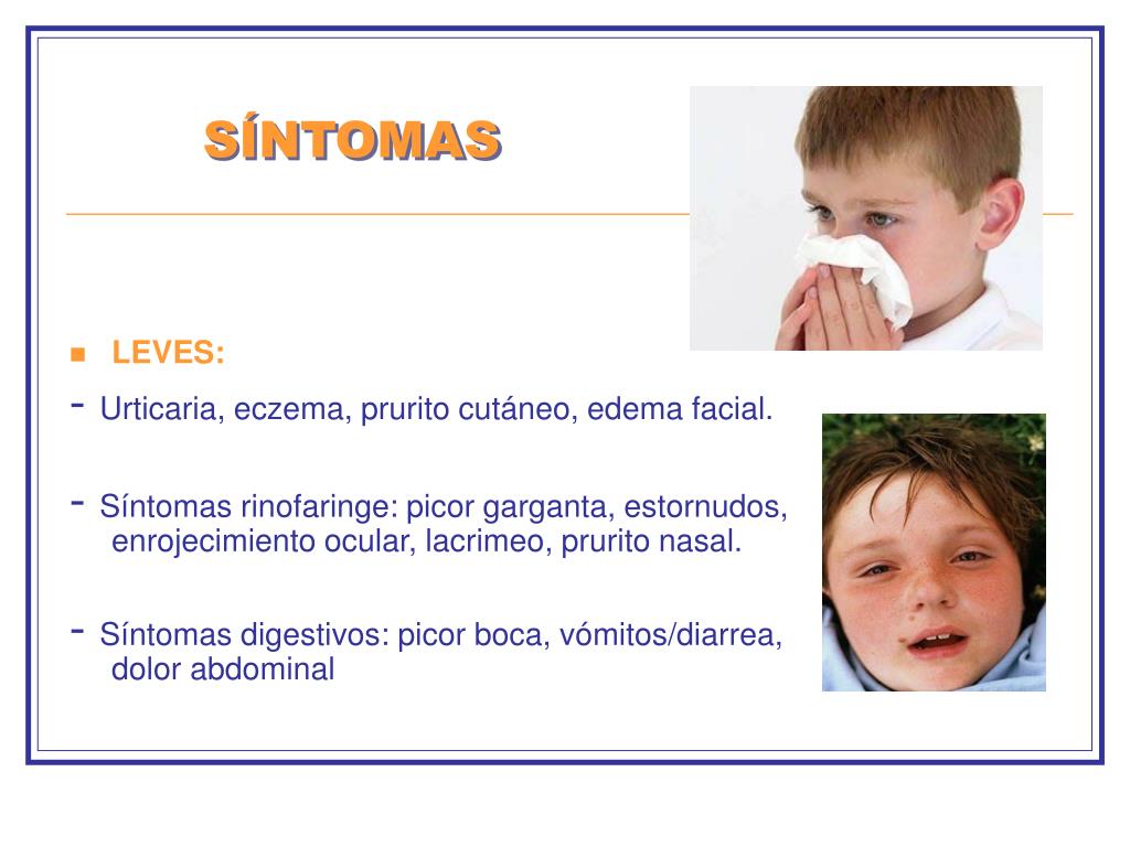 PPT - ALERGIA ALIMENTARIA EN EL COLEGIO PowerPoint Presentation, free ...