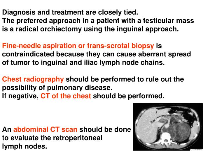 PPT - TUMORI DEL TESTICOLO PowerPoint Presentation - ID:888137