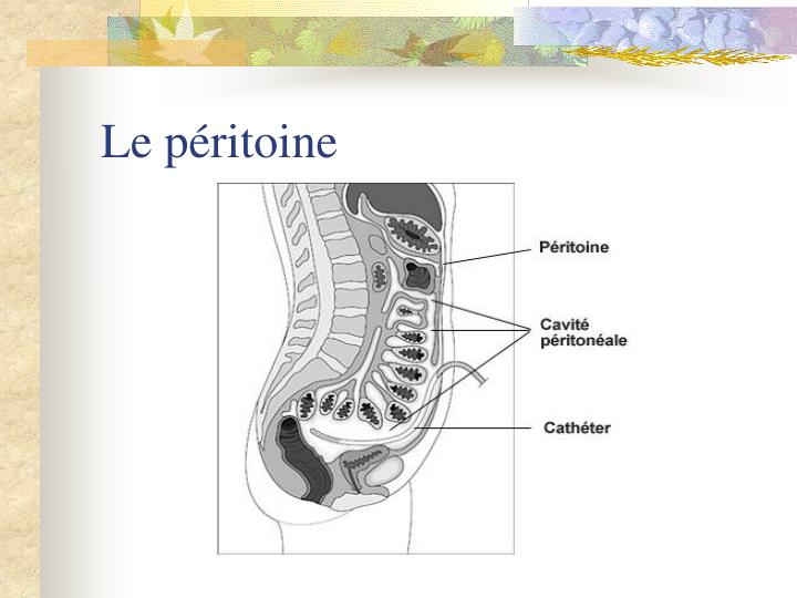 PPT - La dialyse péritonéale PowerPoint Presentation - ID:889028