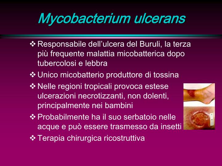 PPT - I micobatteri non tubercolari: aspetti microbiologici e clinici ...