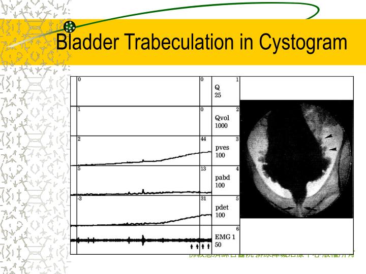 PPT - Anatomy of Lower Urinary Tract PowerPoint Presentation - ID:889810