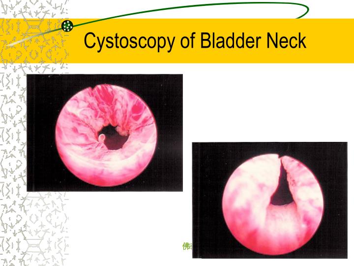 PPT - Anatomy of Lower Urinary Tract PowerPoint Presentation - ID:889810