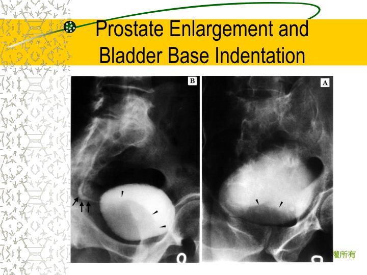PPT - Anatomy of Lower Urinary Tract PowerPoint Presentation - ID:889810