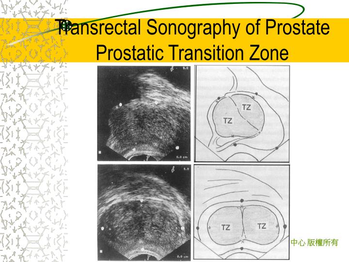 PPT - Anatomy of Lower Urinary Tract PowerPoint Presentation - ID:889810