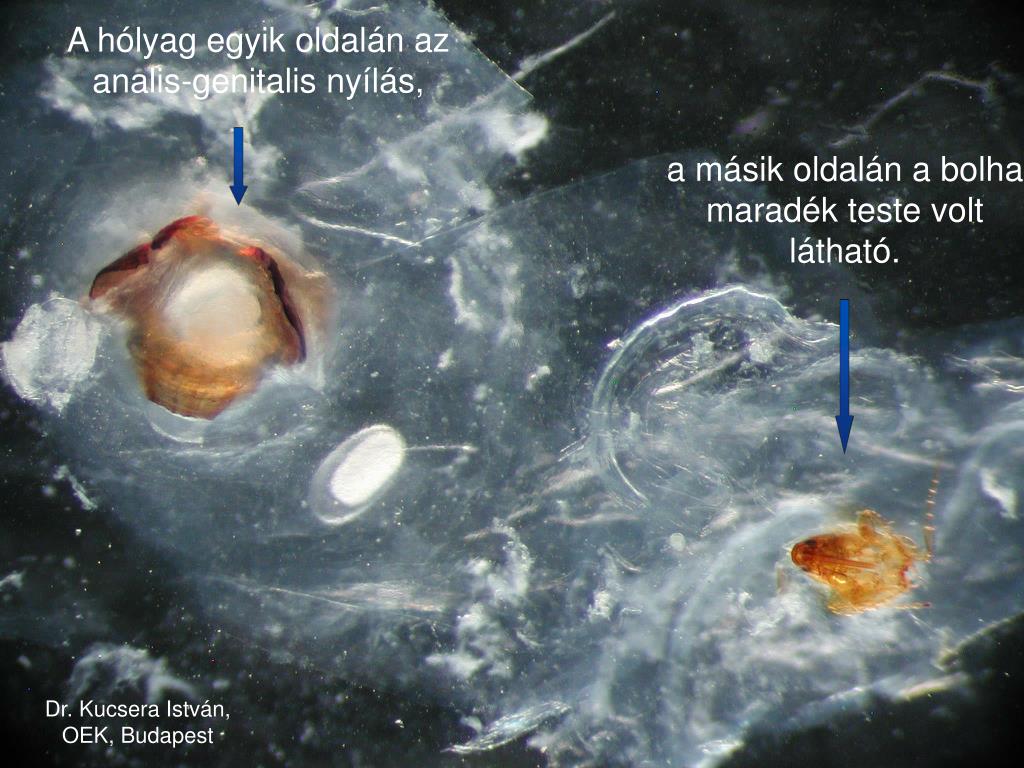 PPT - Magyarországra behurcolt humán tungiasis (Esetismertetés ...