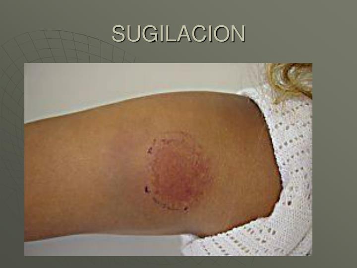 PPT - MEDICINA LEGAL Y FORENSE PowerPoint Presentation - ID:895991