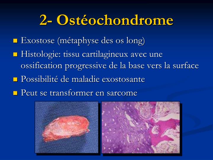 PPT - Aspect Anatomo-pathologique des tumeurs des maxillaires ...