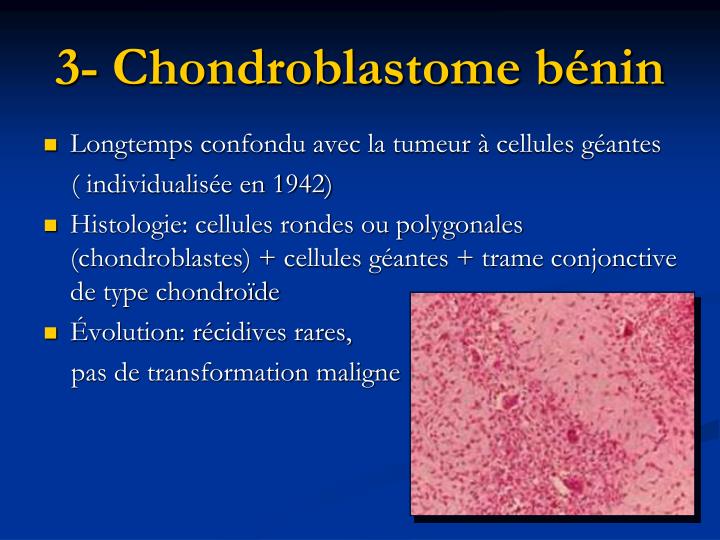 PPT - Aspect Anatomo-pathologique des tumeurs des maxillaires ...