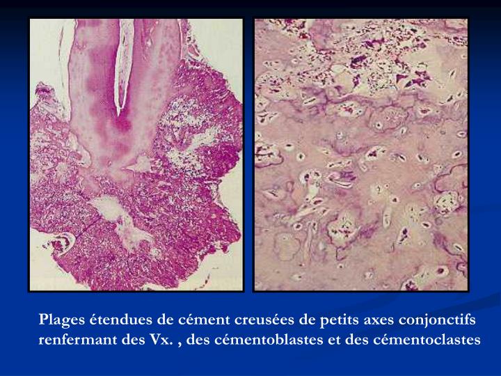 PPT - Aspect Anatomo-pathologique des tumeurs des maxillaires ...