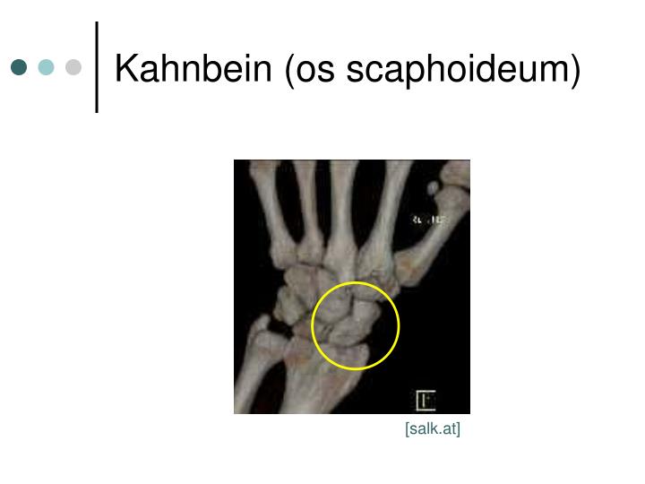 PPT - KAHNBEIN-FRAKTUREN PowerPoint Presentation - ID:896866