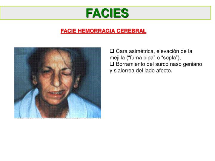 PPT - SEMIOLOGIA NEUROLOGICA PowerPoint Presentation - ID:897645