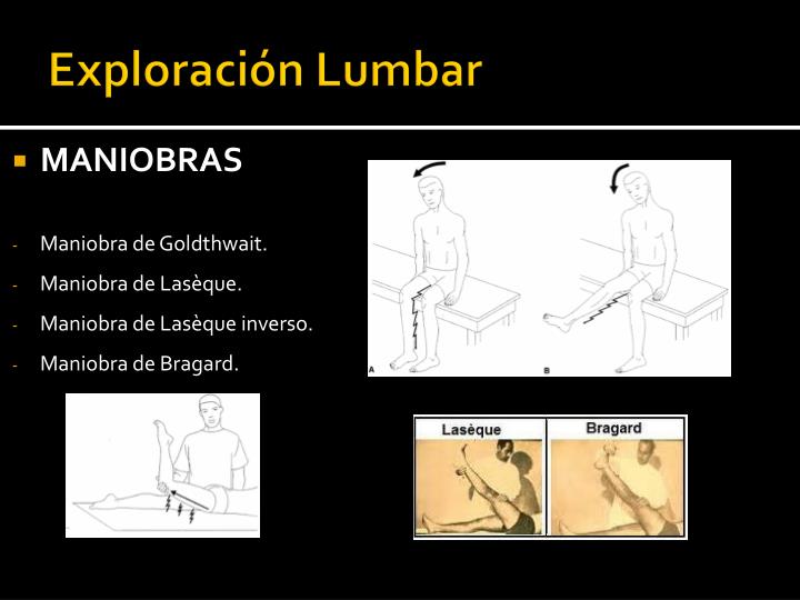 PPT - Semiologia de Columna Vertebral PowerPoint Presentation - ID:898743