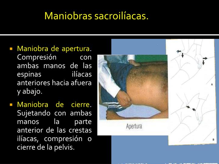 Ppt Semiologia De Columna Vertebral Powerpoint Presentation Id 898743