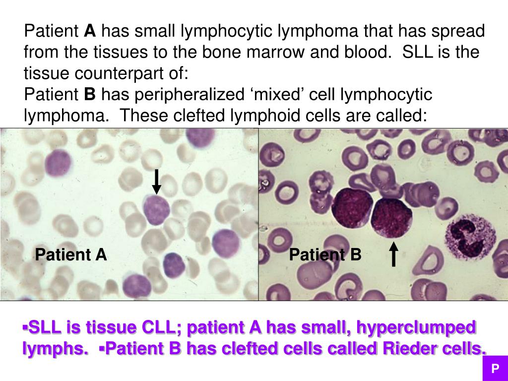 PPT - MT417 - CLINICAL HEMATOLOGY II Linda Sykora, MT(ASCP)SH ...