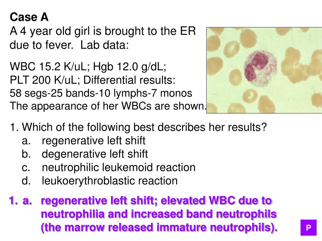 PPT - MT417 - CLINICAL HEMATOLOGY II Linda Sykora, MT(ASCP)SH ...