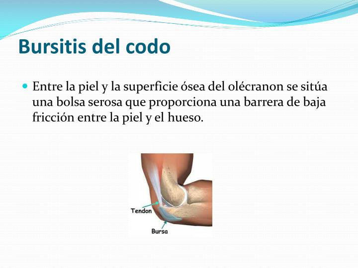 PPT - Lesiones más frecuentes provocadas por movimientos de codo a ...