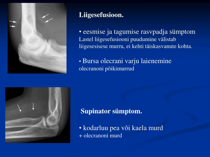 PPT - LUUMURDUDE PILTDIAGNOSTIKA. Karin Veske SA TÜK Maarjamõisa ...