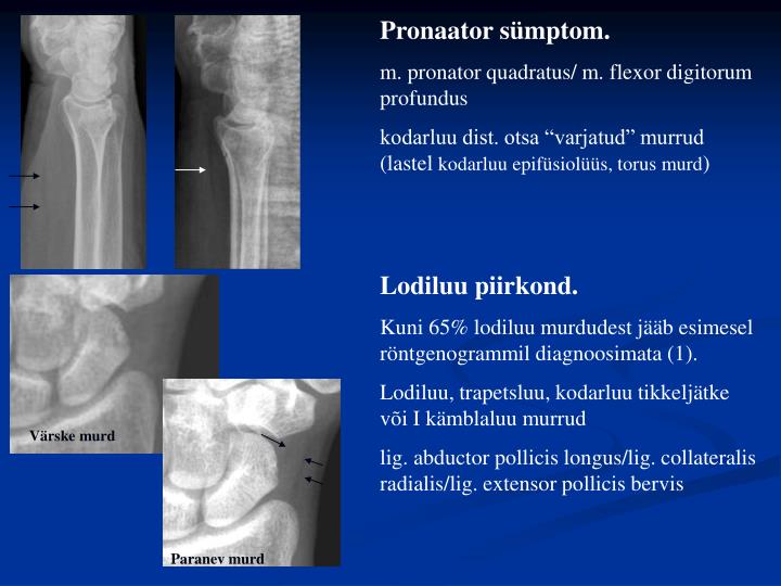 PPT - LUUMURDUDE PILTDIAGNOSTIKA. Karin Veske SA TÜK Maarjamõisa ...