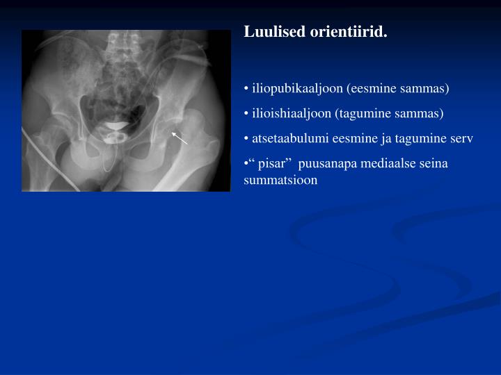 PPT - LUUMURDUDE PILTDIAGNOSTIKA. Karin Veske SA TÜK Maarjamõisa ...