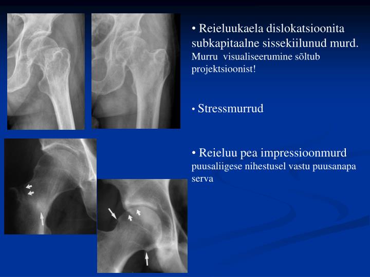 PPT - LUUMURDUDE PILTDIAGNOSTIKA. Karin Veske SA TÜK Maarjamõisa ...