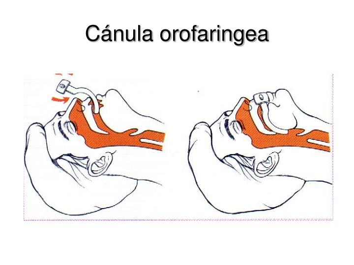 PPT - Manejo Inicial del Paciente Politraumatizado PowerPoint ...