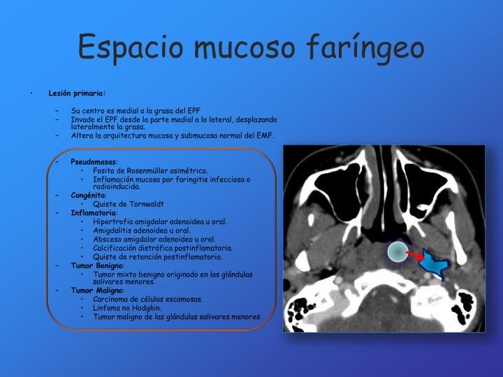 PPT - Anatomía cervical PowerPoint Presentation - ID:903406